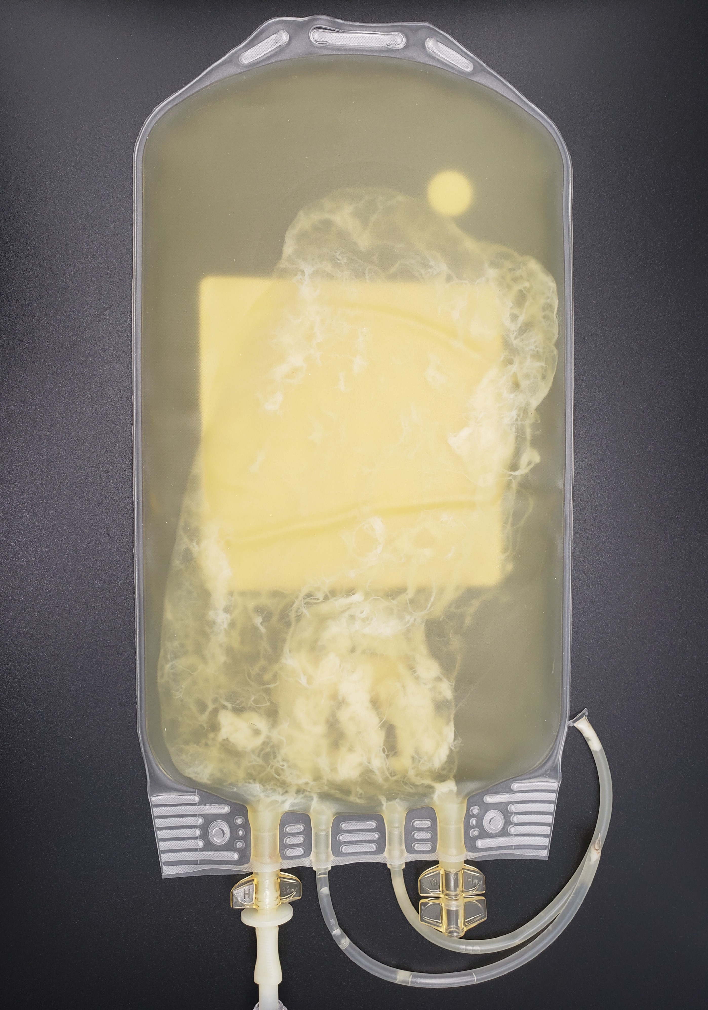 Platelets: Bacterial contamination | Professional Education