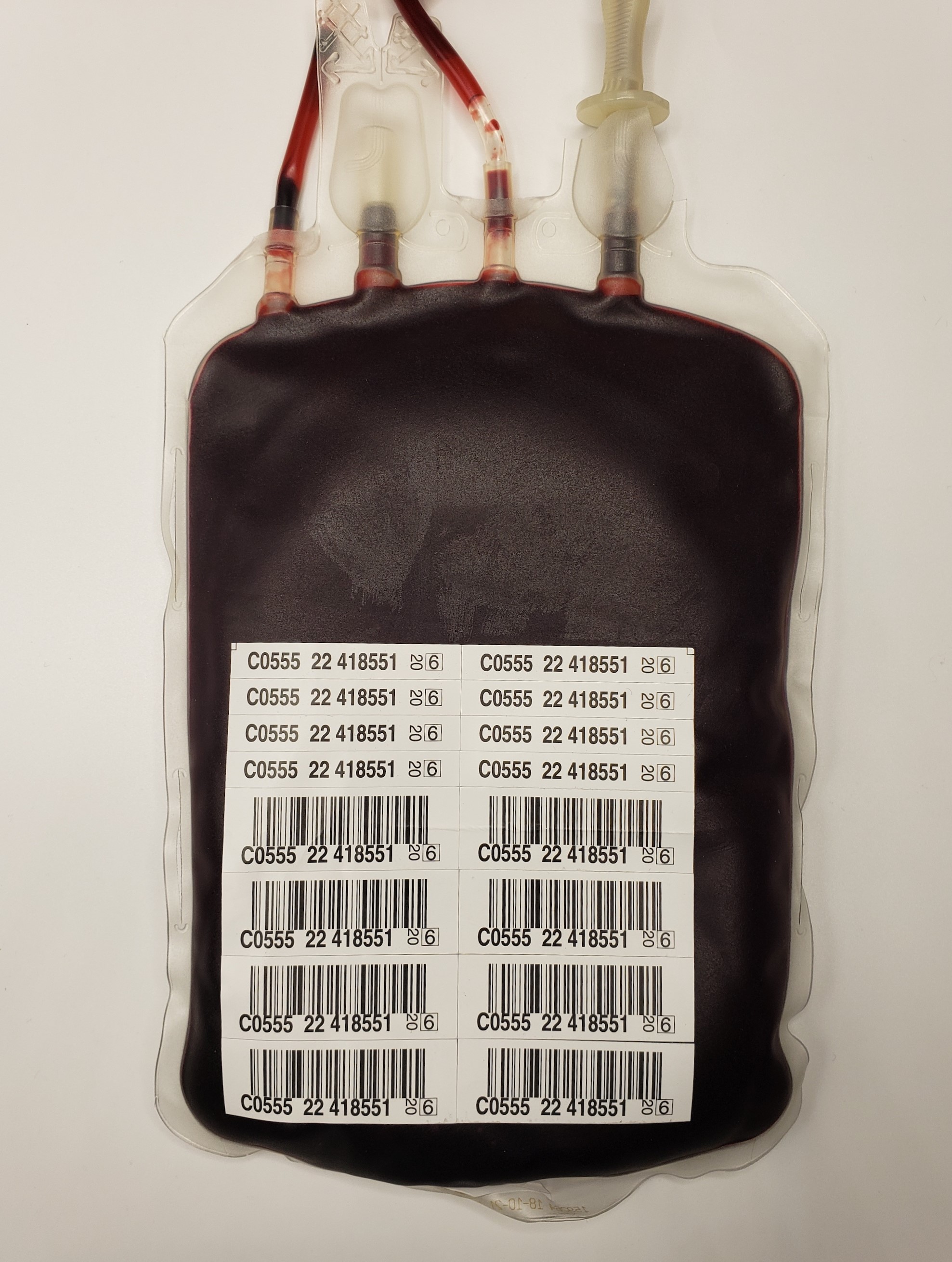 Red blood cells: Bacterial contamination | Professional Education