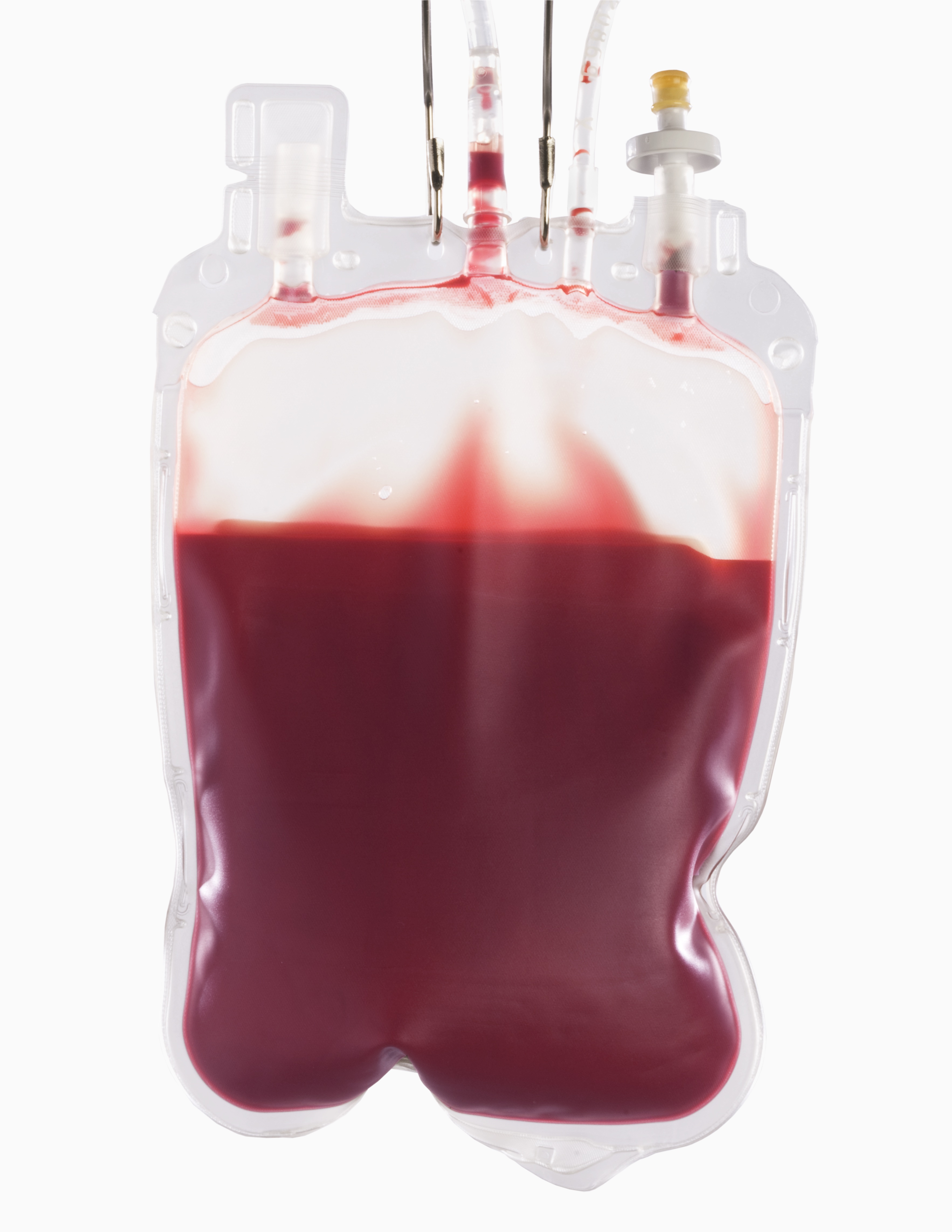 Red blood cells: Hemolysis | Professional Education