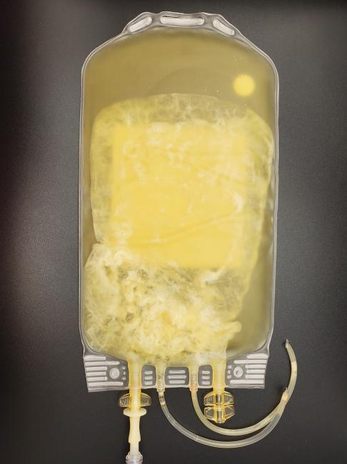 Platelets: Bacterial contamination | Professional Education