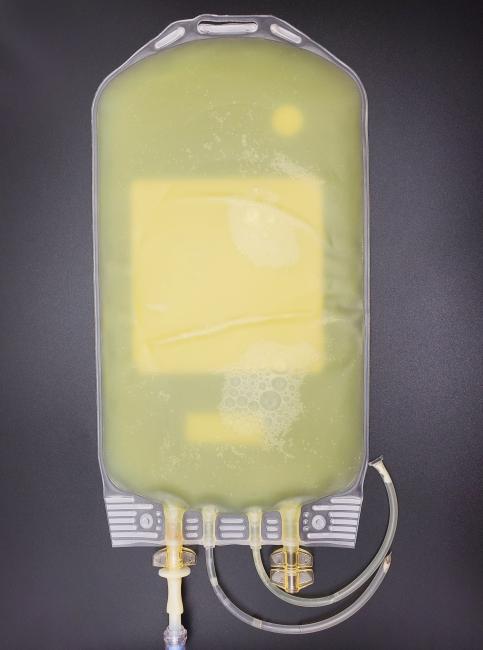 Platelets: Bacterial contamination | Professional Education