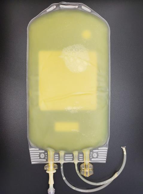 Platelets: Bacterial contamination | Professional Education