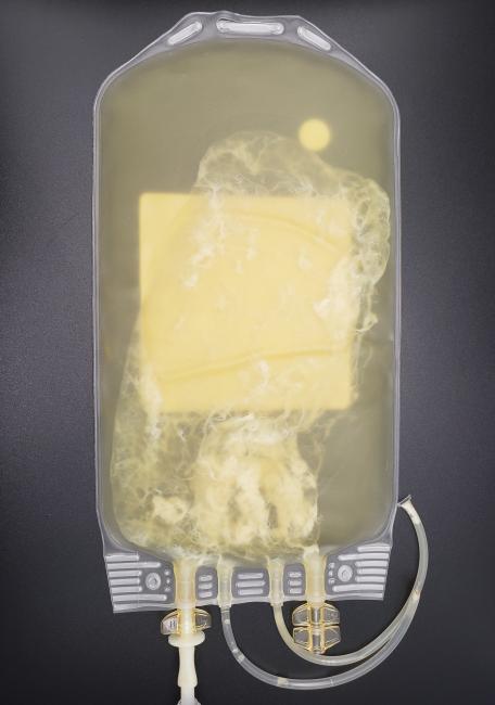 Platelets: Bacterial contamination | Professional Education