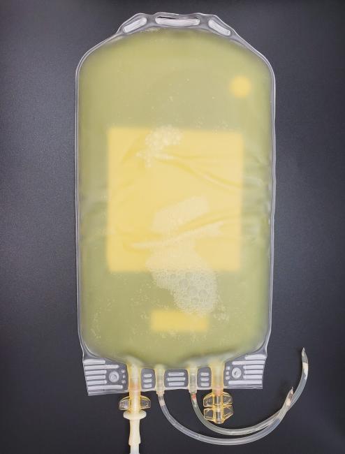 Platelets: Bacterial contamination | Professional Education