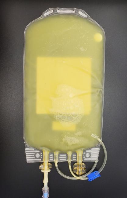 Platelets: Bacterial contamination | Professional Education