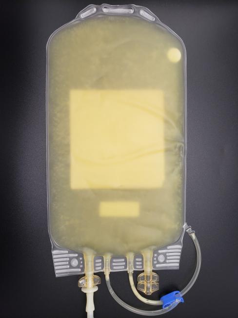 Platelets: Bacterial contamination | Professional Education