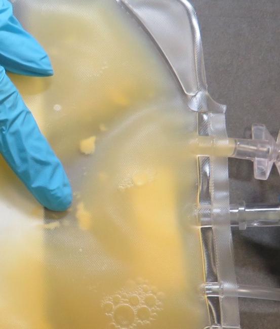 Platelets: Particulate matter | Professional Education