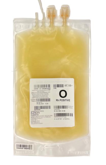 Platelets: Lipemia | Professional Education