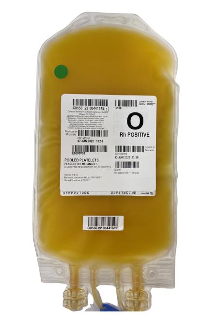 Platelets: Bacterial contamination | Professional Education