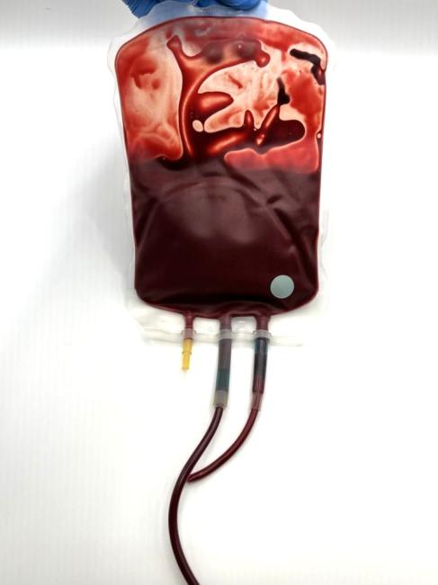 Red blood cells: Bacterial contamination | Professional Education