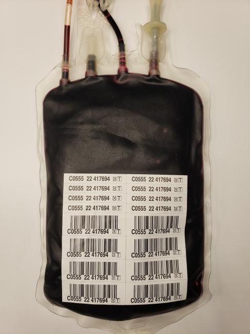 Red blood cells: Bacterial contamination | Professional Education