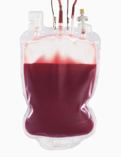 Red blood cells: Hemolysis | Professional Education